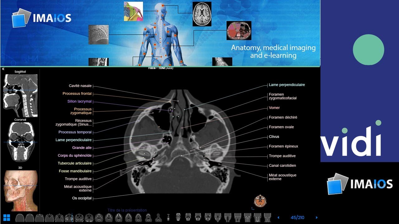 IMAIOS et Vidi concluent un partenariat professionnel en faveur de la ...